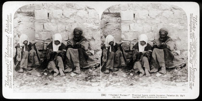The dramatic cleansing of the leper